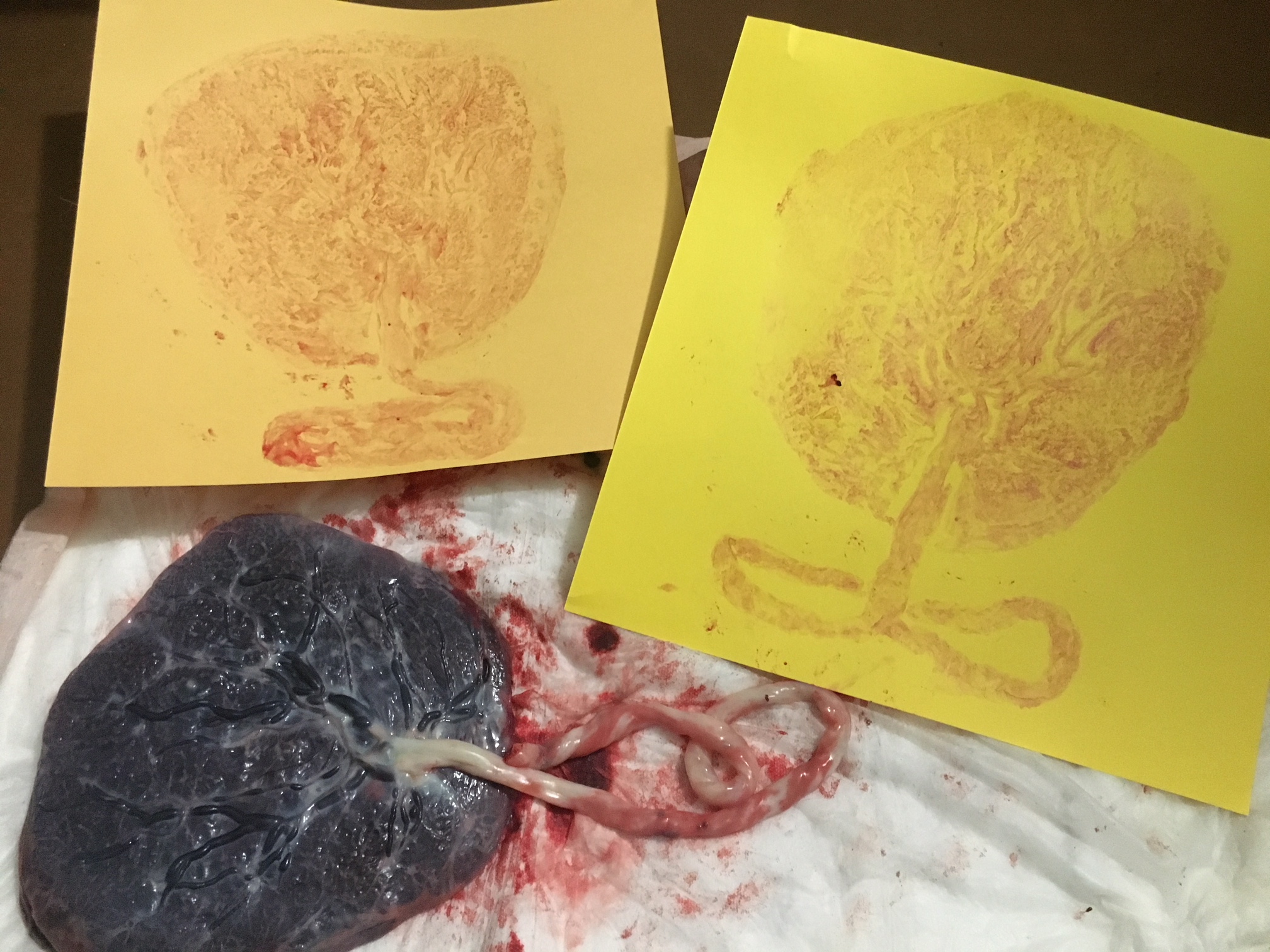 Placentas - Phoenix Arizona Homebirth Midwife Freedom and the Seed ...